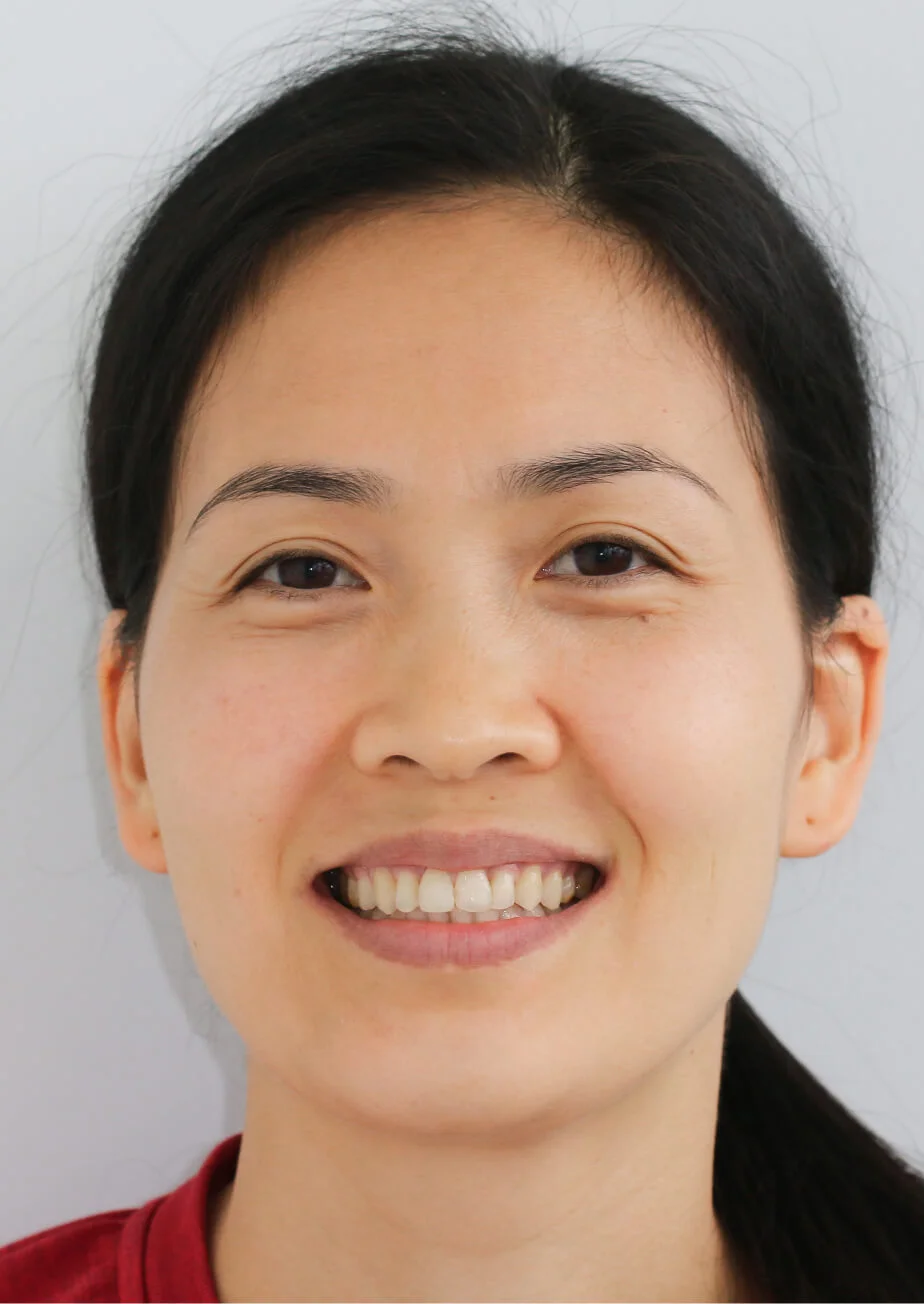 Bespoke Smiles Gallery